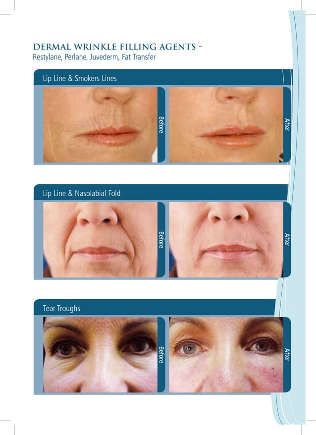 Absolute Cosmetic Medicine Brochure | PDF