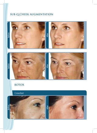 Absolute Cosmetic Medicine Brochure | PDF