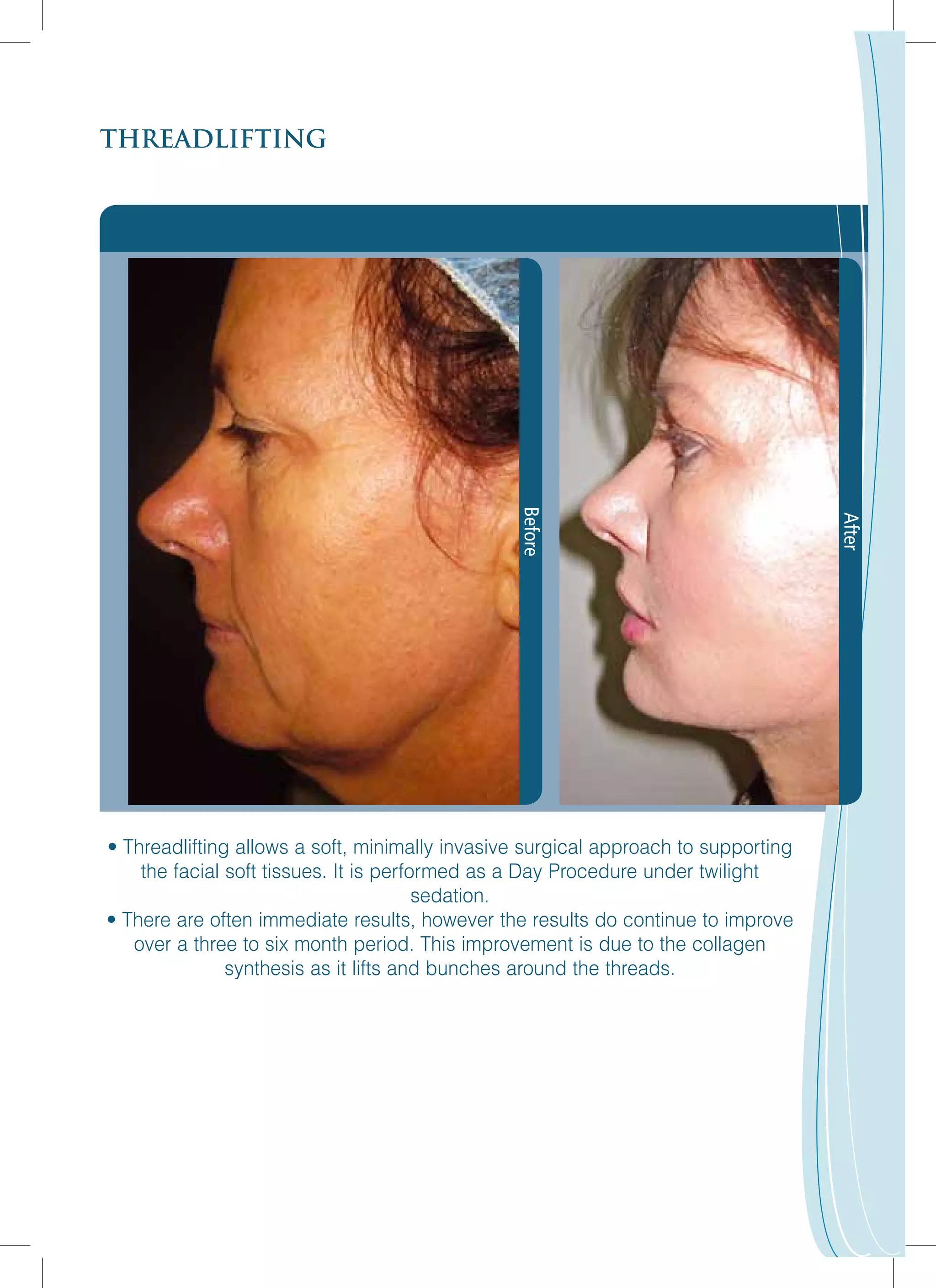 Absolute Cosmetic Medicine Brochure | PDF