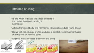 Abrasion and Contusion MedicoLegalAspects.pptx