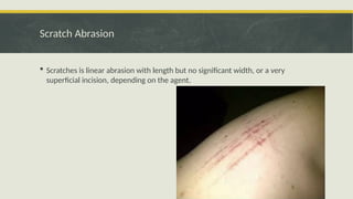 Abrasion and Contusion MedicoLegalAspects.pptx