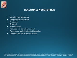 Tipos de Acné, sus complicaciones y tratamientos | PPT