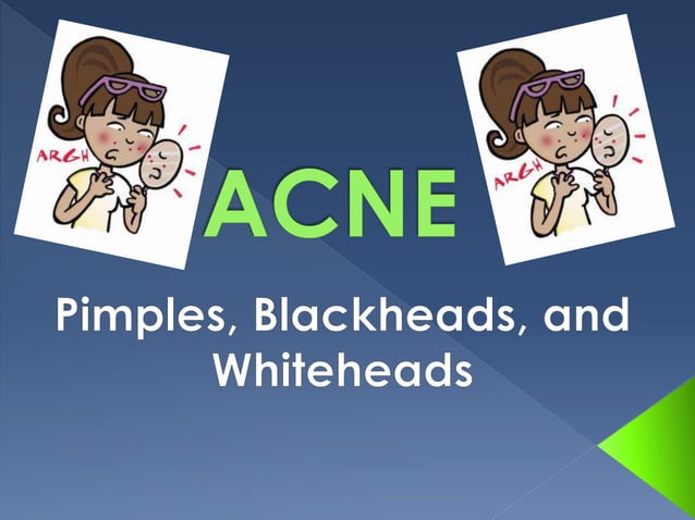 Acne | PPTX | Skin and Dermatology | Diseases and Conditions