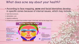 Acne | PPTX