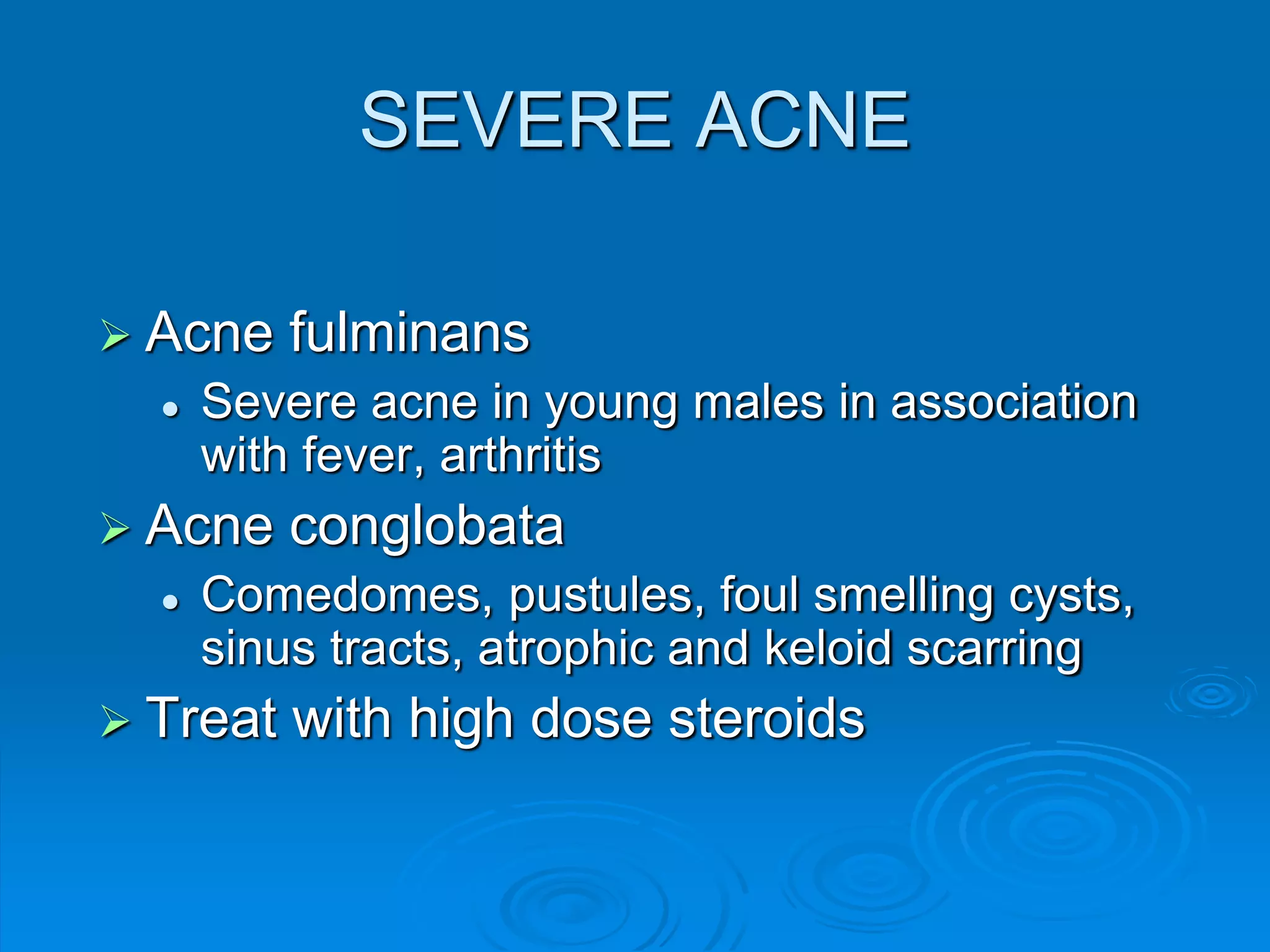 Acne.ppt