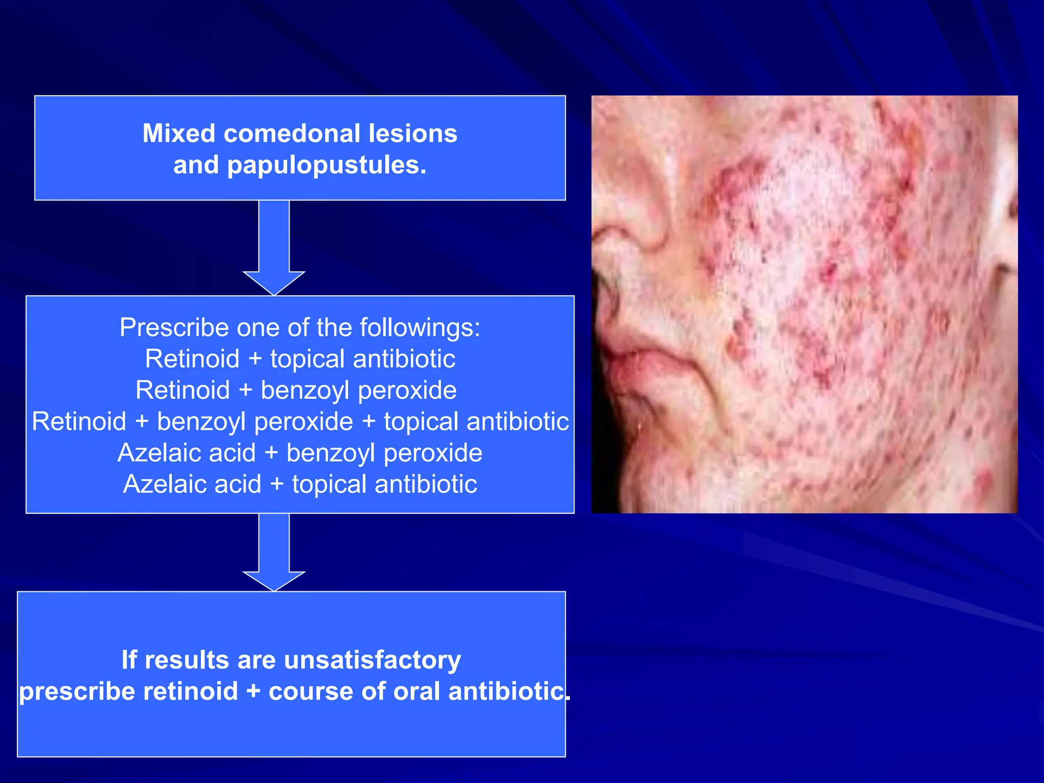 acne.ppt pharmacotherapy for treating acne | PPT