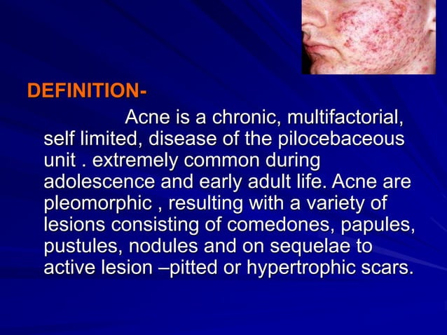 acne.ppt pharmacotherapy for treating acne | PPT | Skin and Dermatology ...