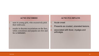 physiotherapy in Acne condition.....pptx