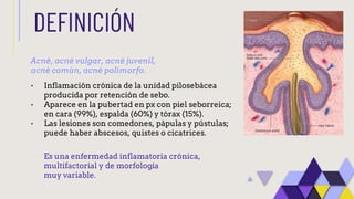 Acné enfoque médico, fisiopatologia y tratamiento.pptx