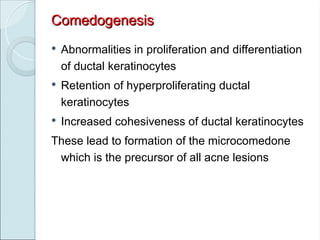 ACNE VULGARIES One of the commonest skin conditions .PPT