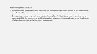 Acne- pathophysiology and types of acne. | PPTX