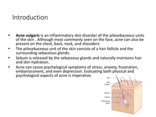Acne vulgaris | PPT