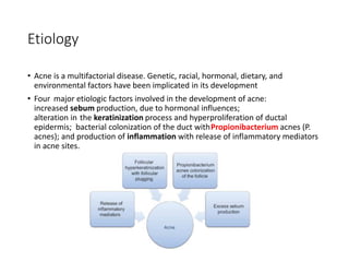 Acne vulgaris | PPT