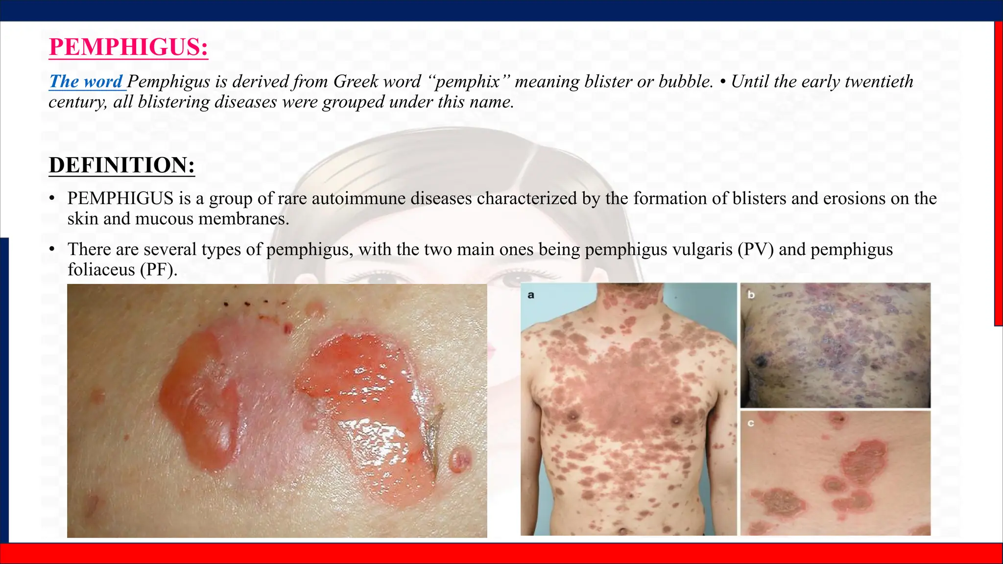 ACNE VULGARIS , ALLERGIES, ECZEMA, PEMPHIGUS.pdf
