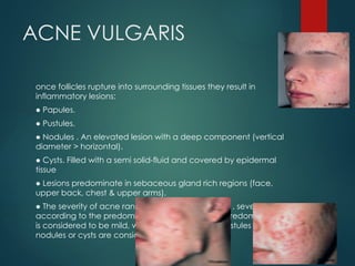 ACNE AND ACNEIFORM ERUPTIONS presentation II.pptx