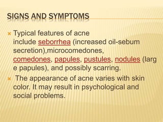 Acne and eye | PPTX