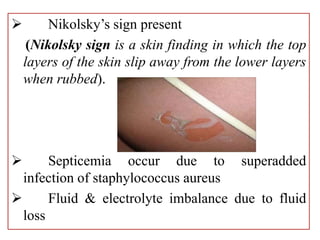 Acne disorders, pemphigus vulgaris, psoriasis.pptx