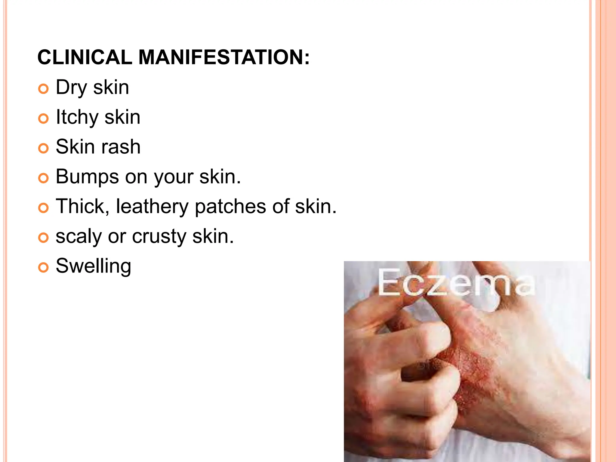 Acne,eczema and pemphigus.pptx