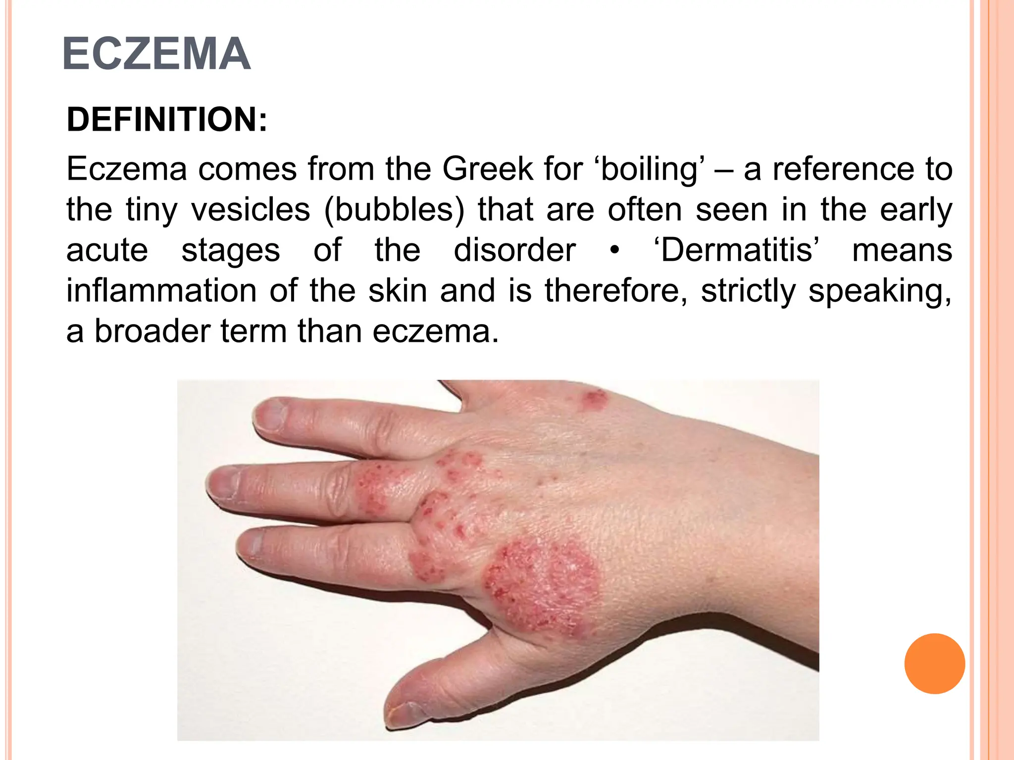 Acne,eczema and pemphigus.pptx