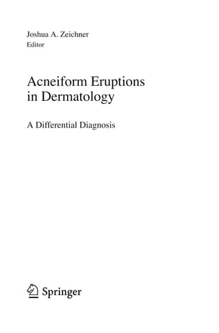 Acneiform Eruptions in Dermatology_ A Differential Diagnosis. 2014.pdf