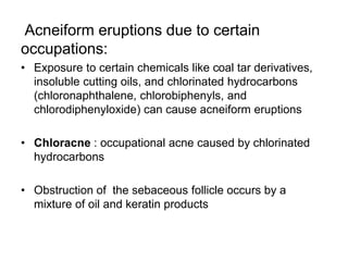 acneiform lesions.pptx