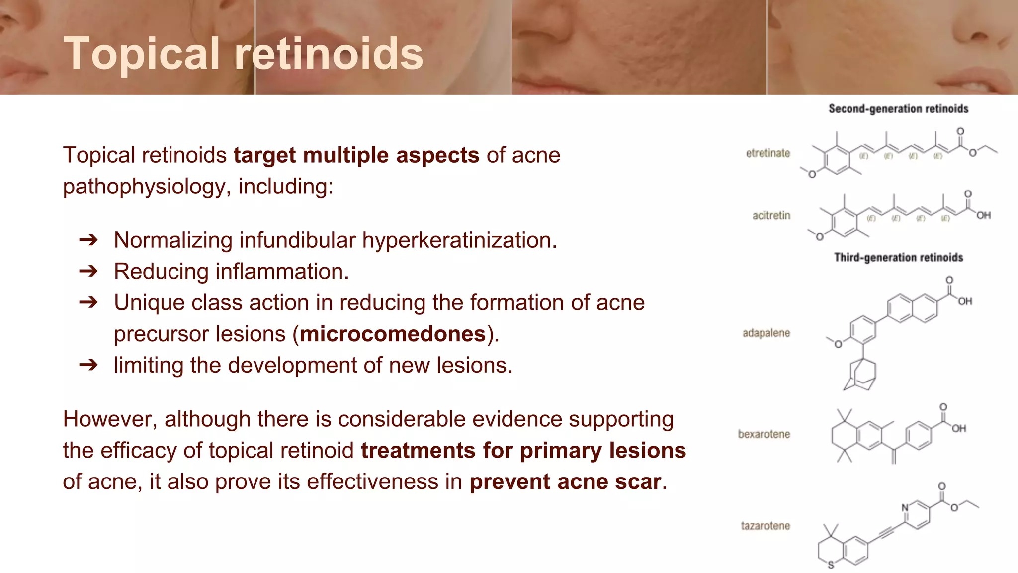 Practical guideline for the acne management | PPTX