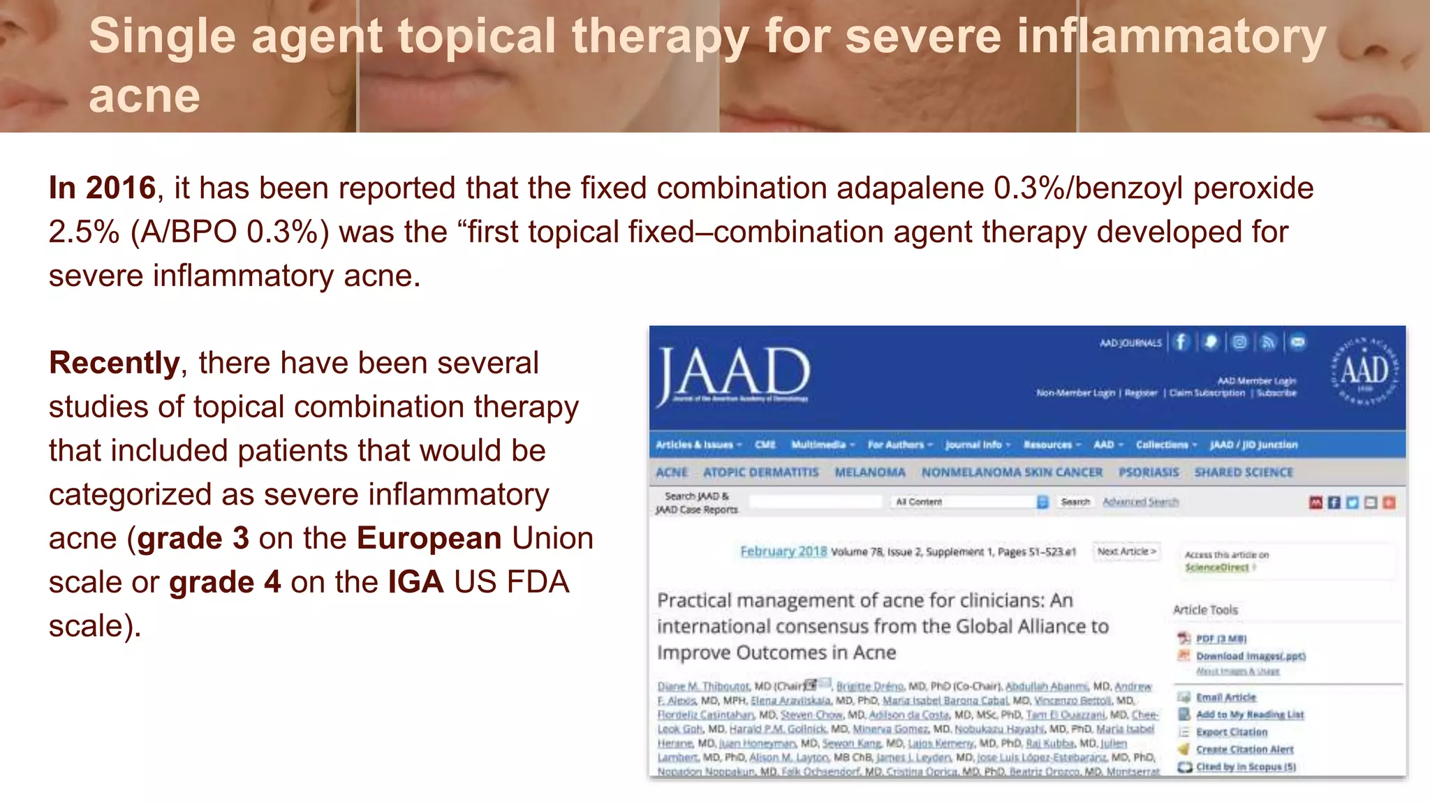 Practical guideline for the acne management | PPTX
