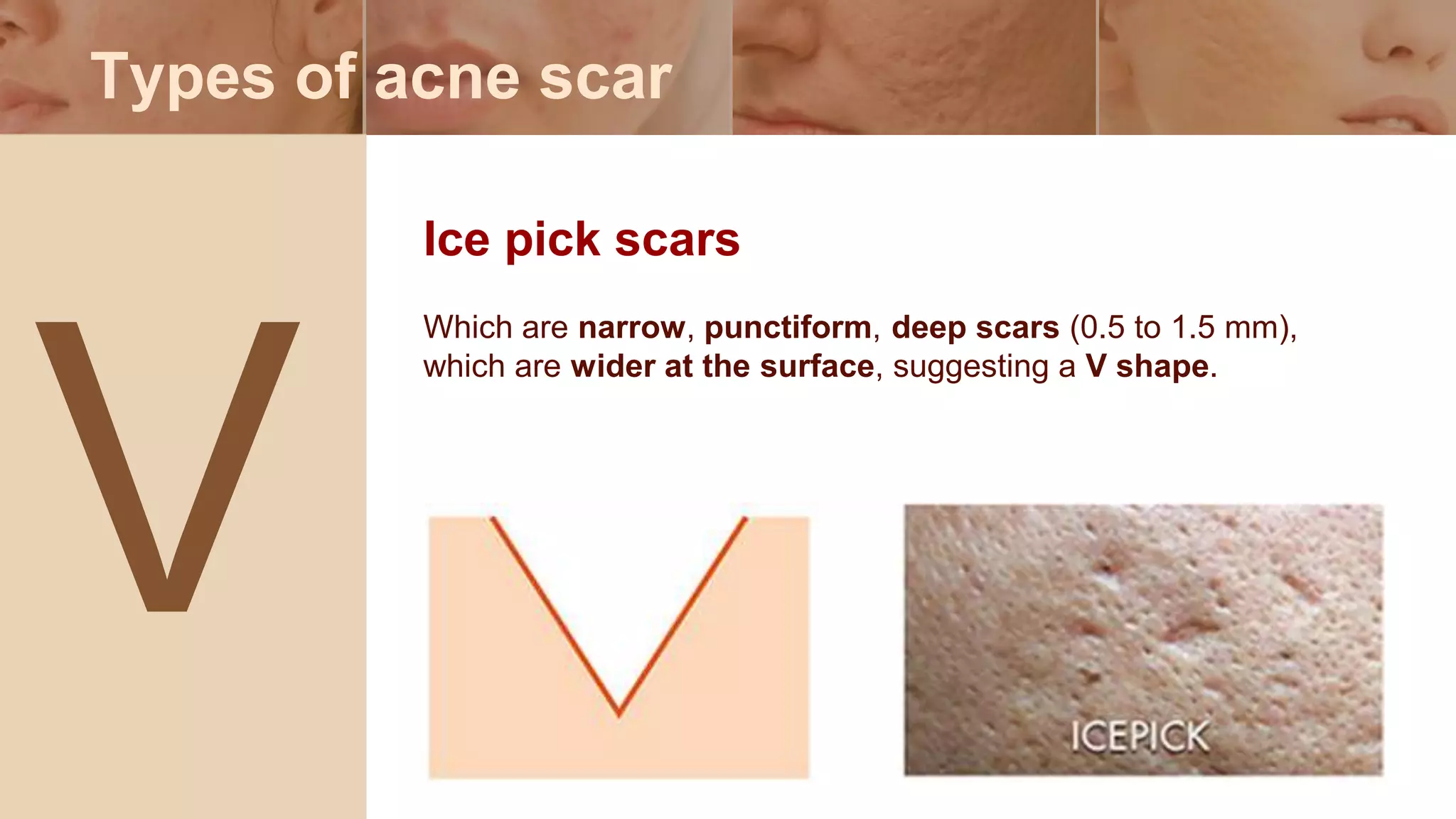 Practical guideline for the acne management | PPTX