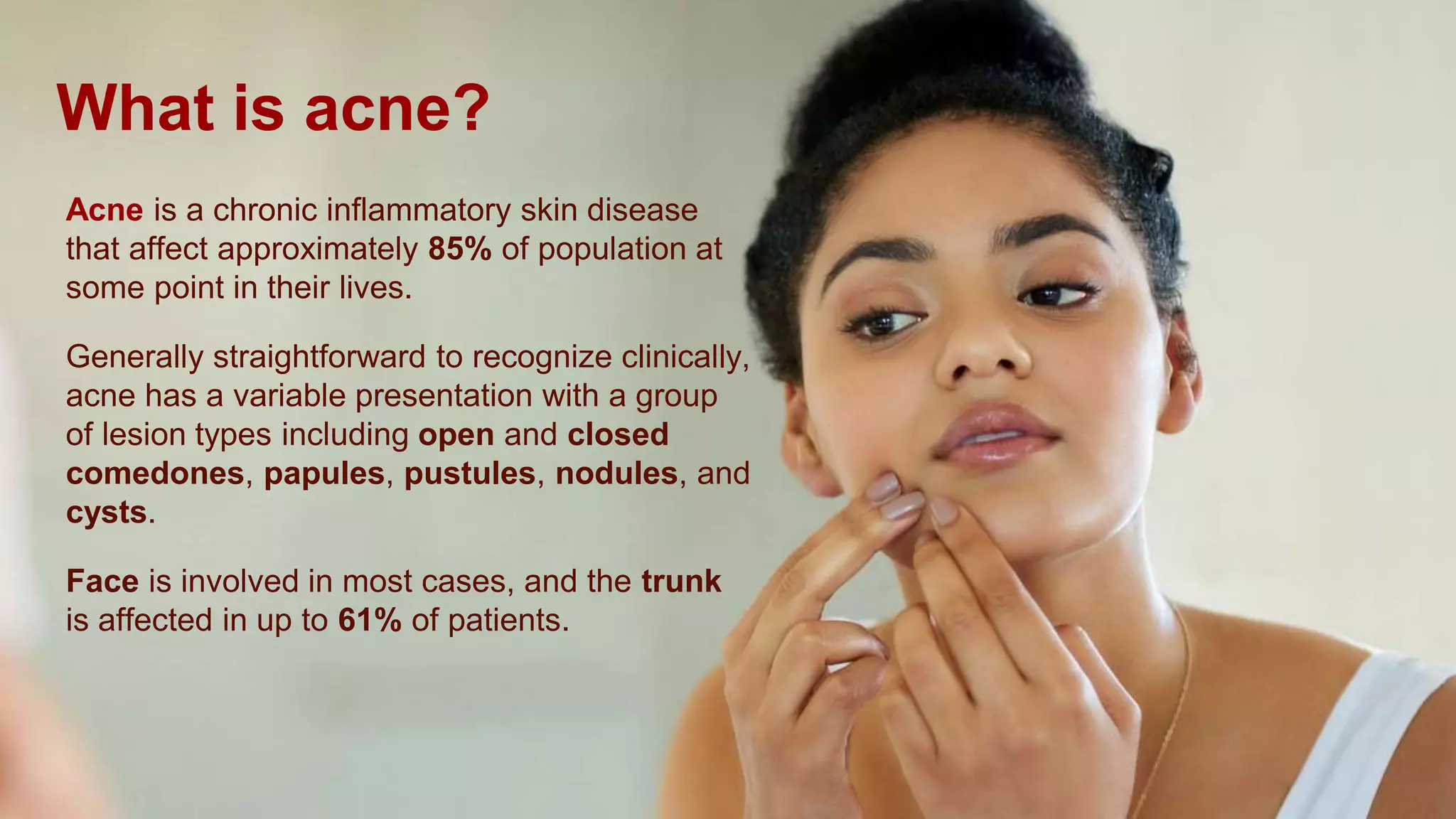 Practical guideline for the acne management | PPTX