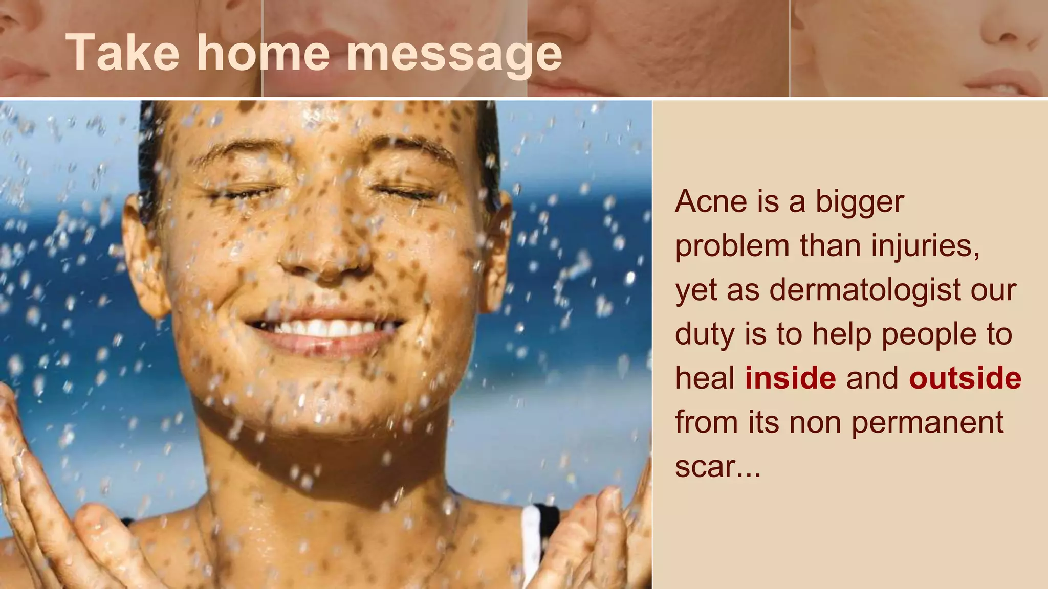 Practical guideline for the acne management | PPTX