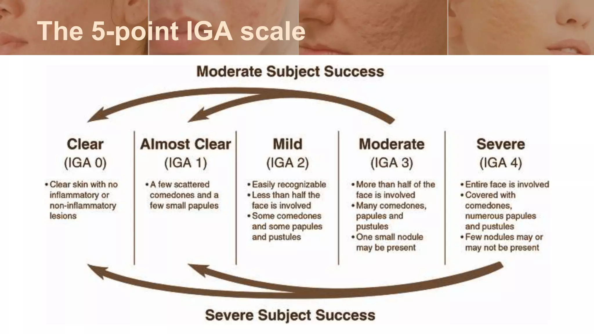 Practical guideline for the acne management | PPTX