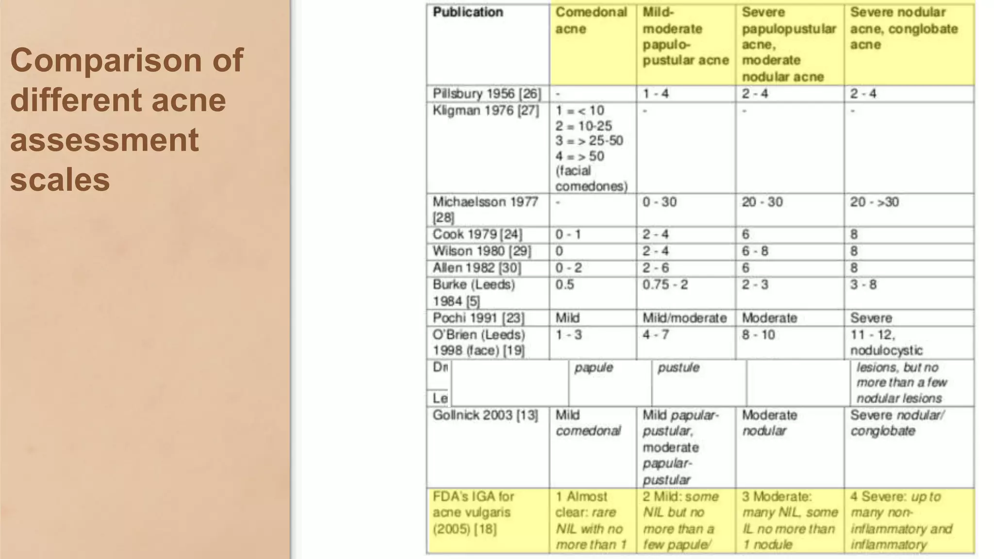 Practical guideline for the acne management | PPTX