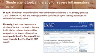 Practical guideline for the acne management | PPTX