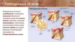 Practical guideline for the acne management | PPTX