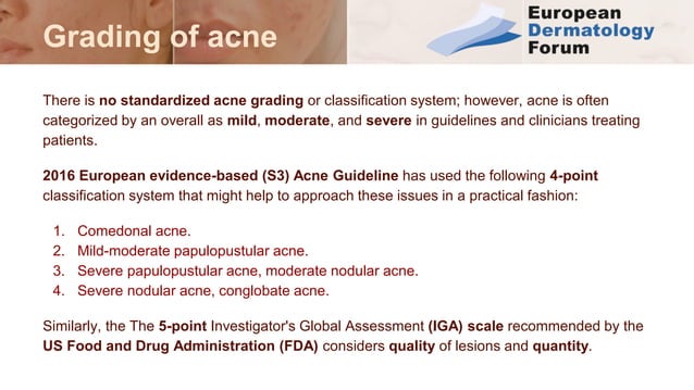 Practical guideline for the acne management | PPTX