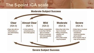 Practical guideline for the acne management | PPTX