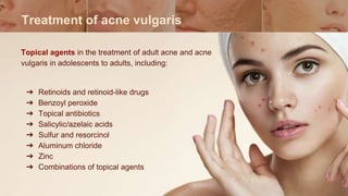 Practical guideline for the acne management | PPTX