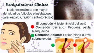 GRUPO ACNÉ OFICIAL DEMATOLOGÍA CLÍNICA.pptx