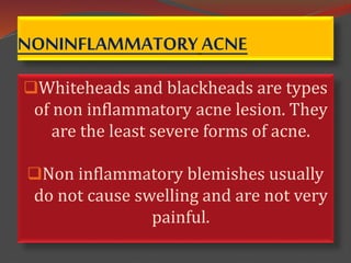 Acne ppt | PPTX | Skin and Dermatology | Diseases and Conditions