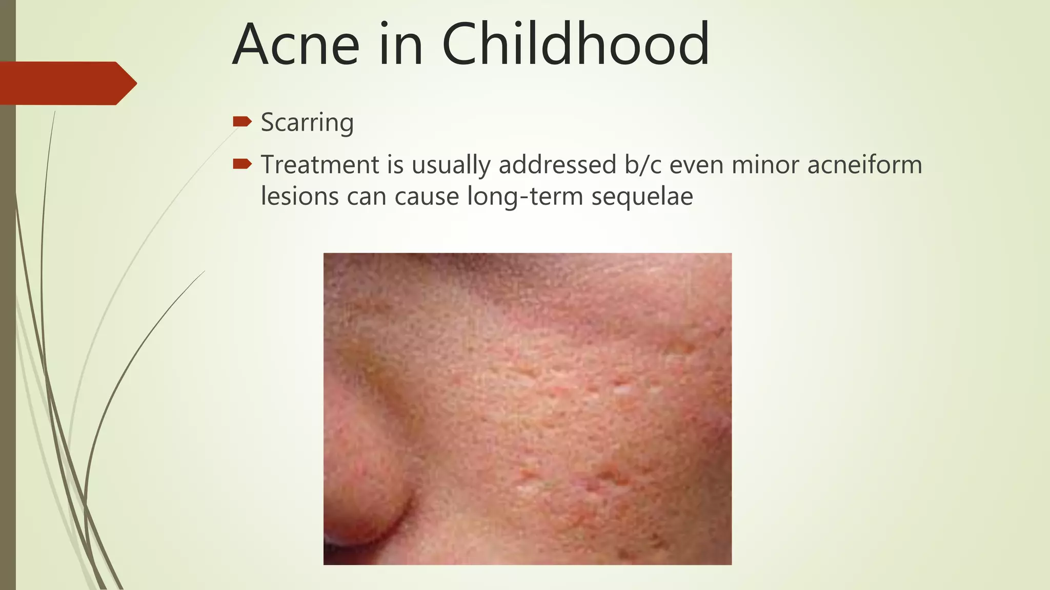 Acne presentation | PPTX | Pregnancy | Reproductive Health