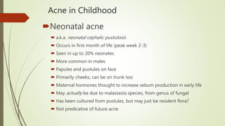 Acne presentation | PPTX