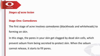 Acne-prone skin & oily skin | PPTX