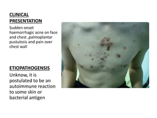 Acne with systemic syndromes | PPTX