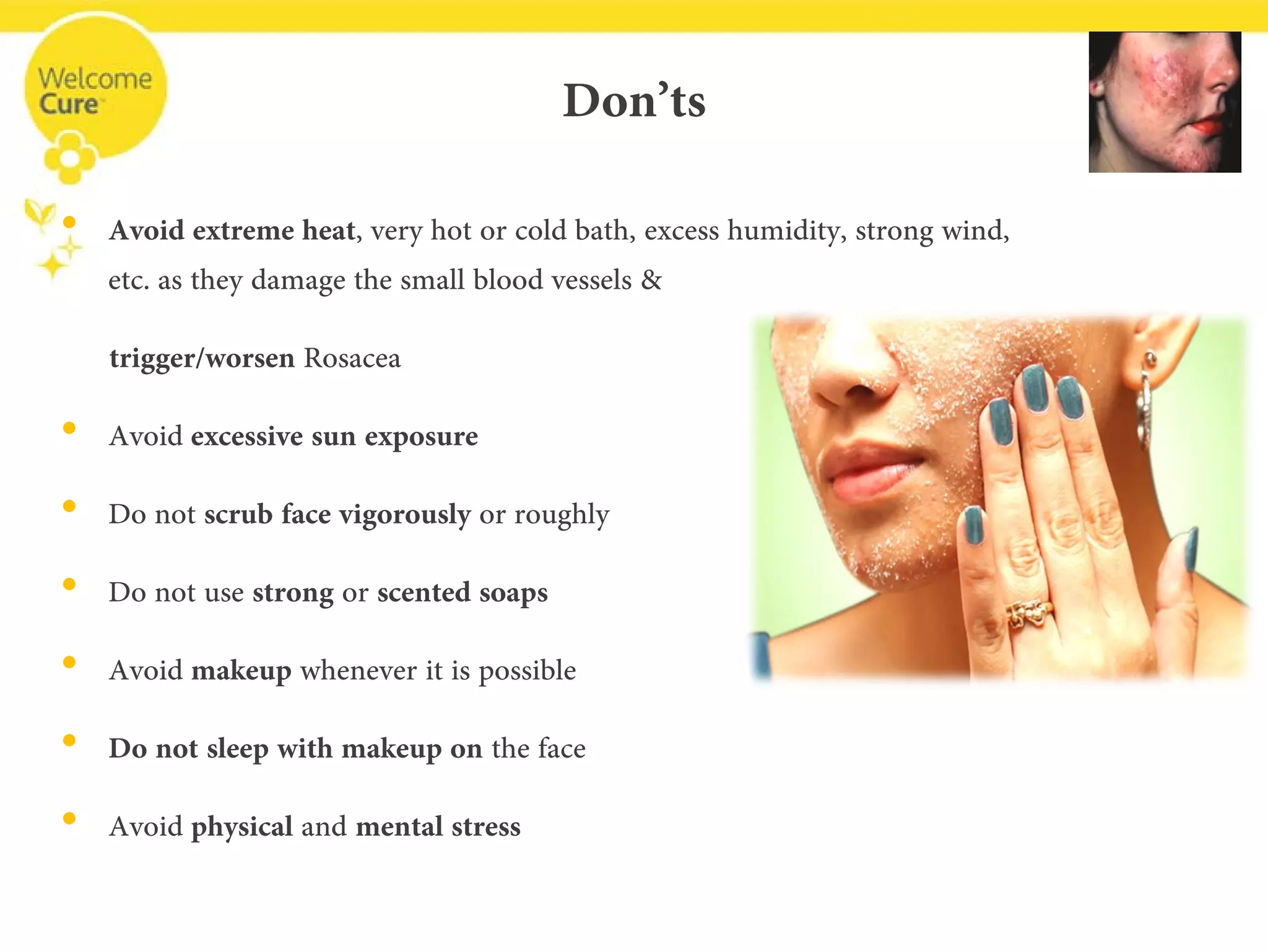 Acne Rosacea- The Disease, Its Complications And Homeopathic Treatment ...