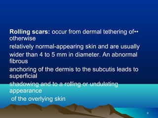 Acne scar treatment | PPT