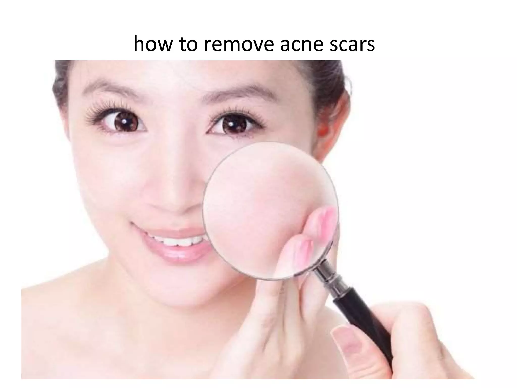 Acne Scar Removal Ppt