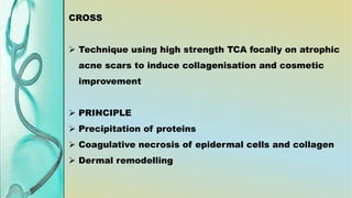 surgical management of acne scars | PPTX
