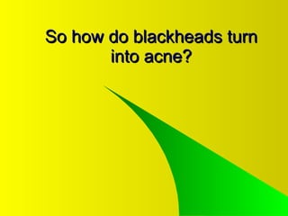 Acne Slide Show | PPT