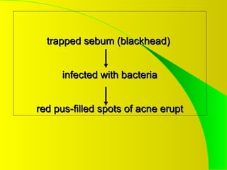 Acne Slide Show | PPT