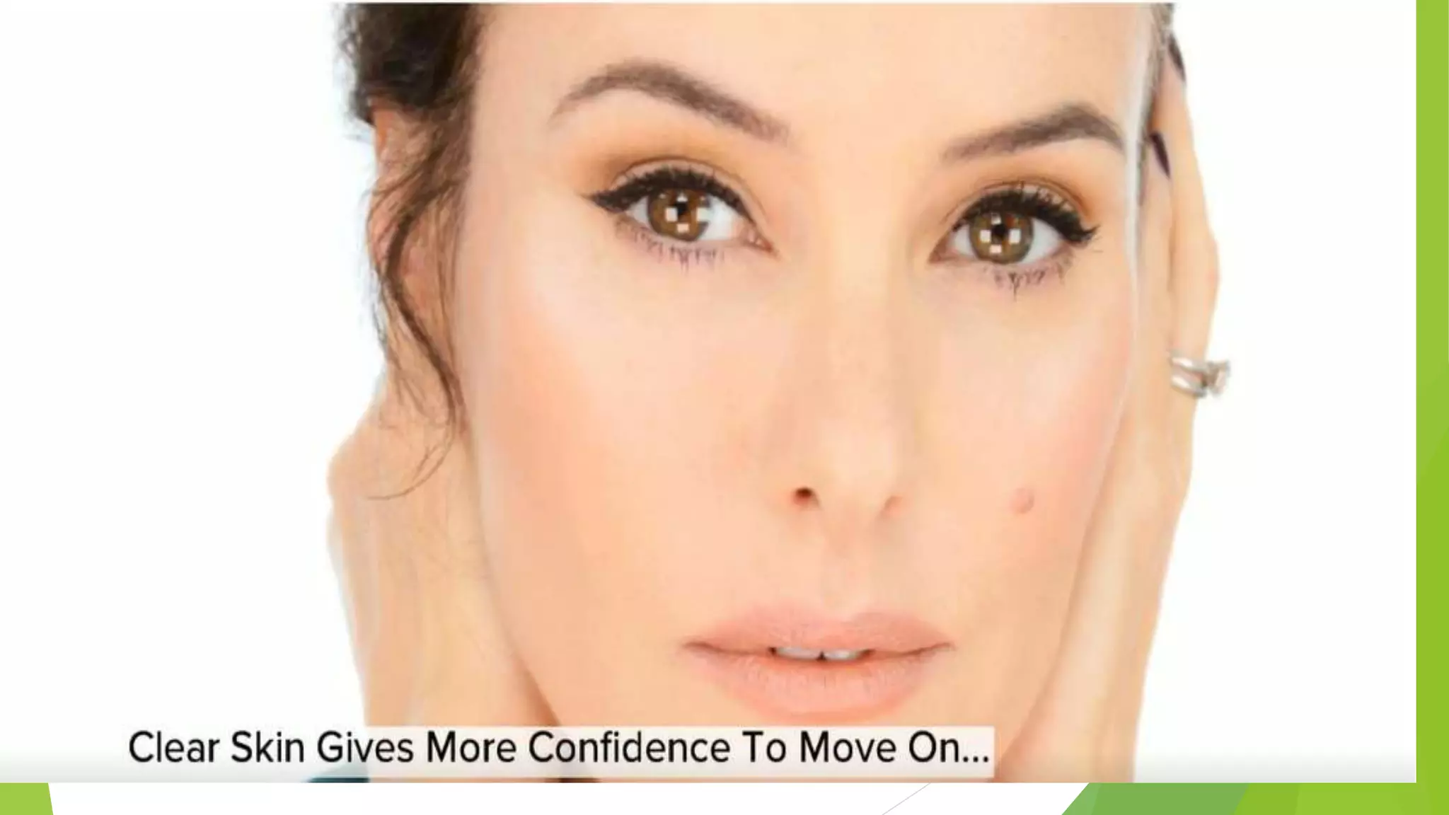 Acne Clear Skin - Acnestar | PPTX